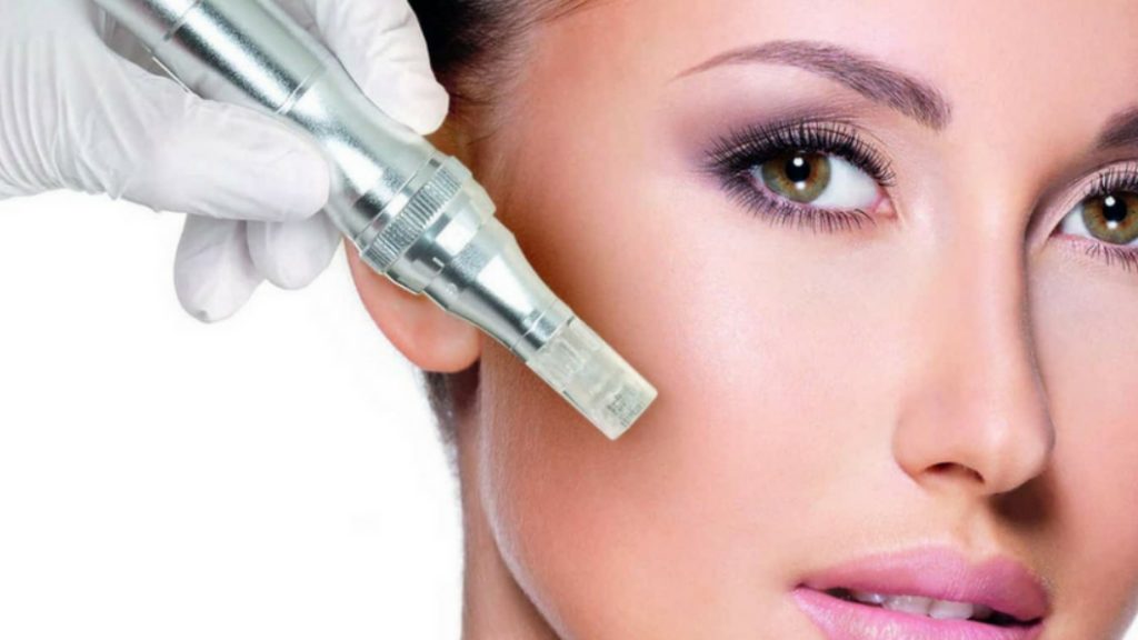 Micro needling mesotherapy – Sun Goddess Skin Aesthetics